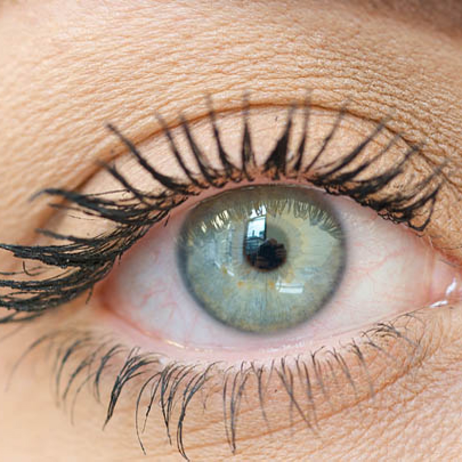 Red Eye Service | Direct Vision Opticians - Manchester